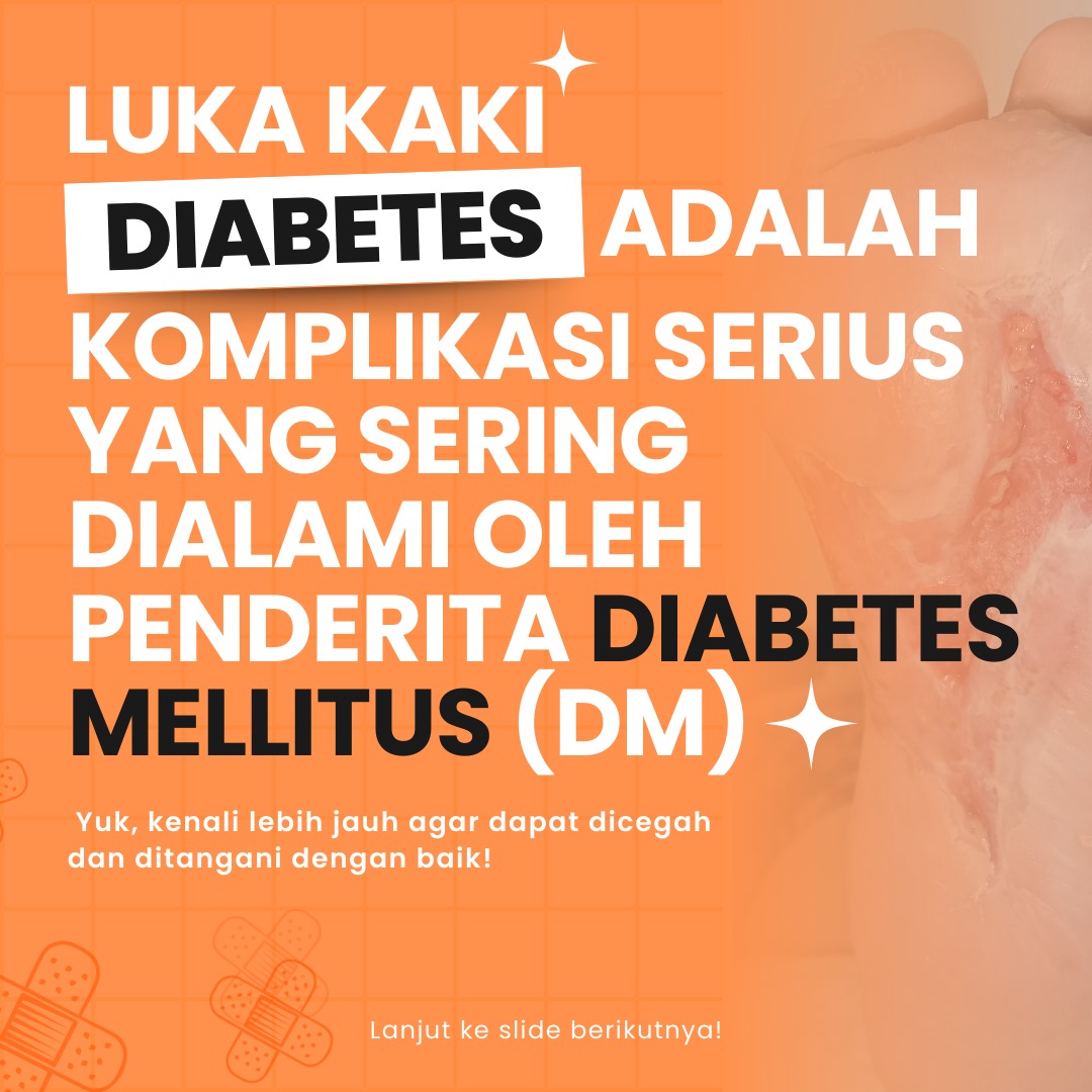 Wocare | Wocare Indonesia